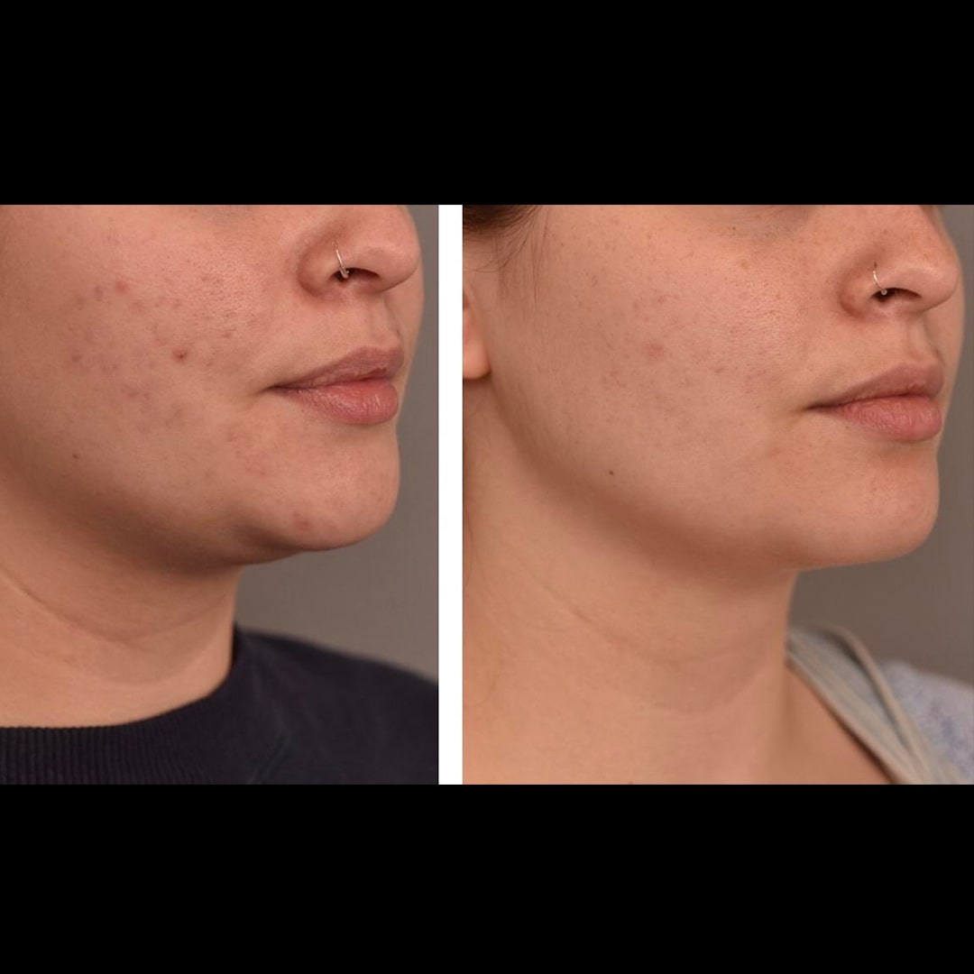 Dermatologist - Royal Cosmetic Surgery Islamabad