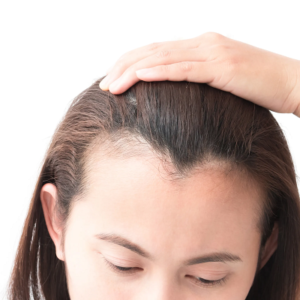 Best Female Edges Restoration in Islamabad