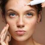 How to tell if acne is hormonal or bacterial?