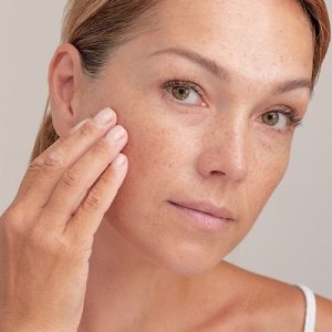 What is the first line treatment for melasma?